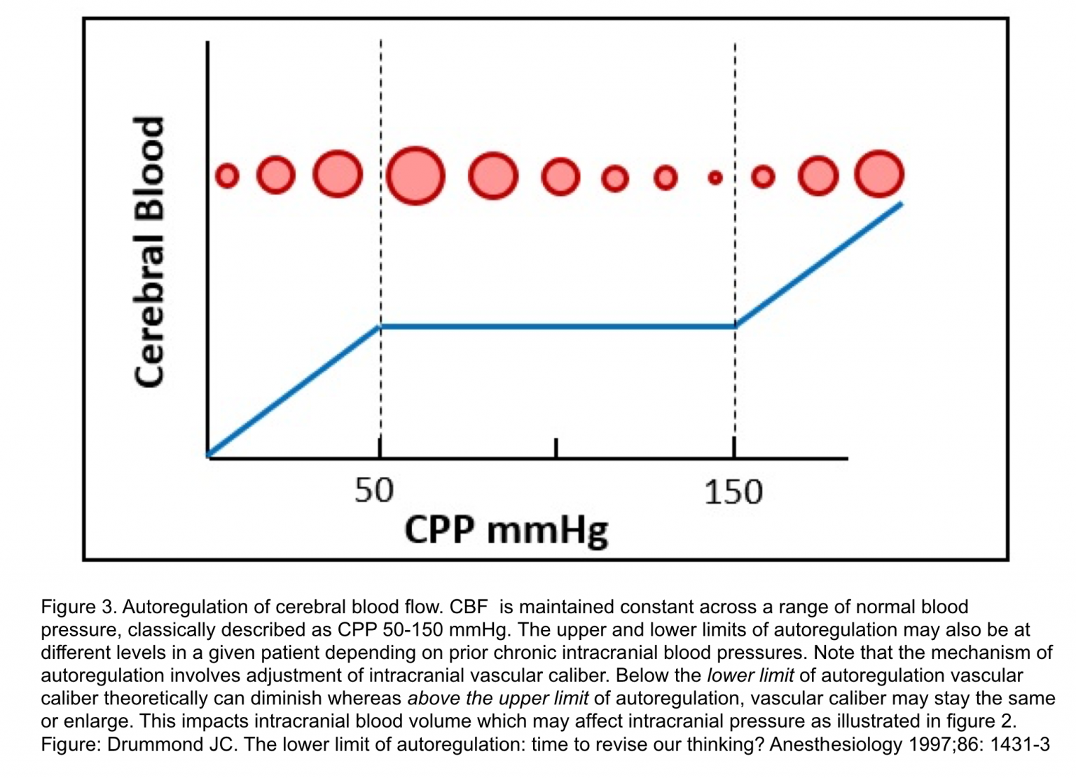 Secondary Brain Injury: “Time is the Brain” | RECAPEM