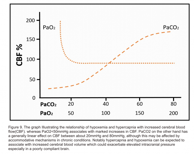 Secondary Brain Injury: “Time is the Brain” | RECAPEM