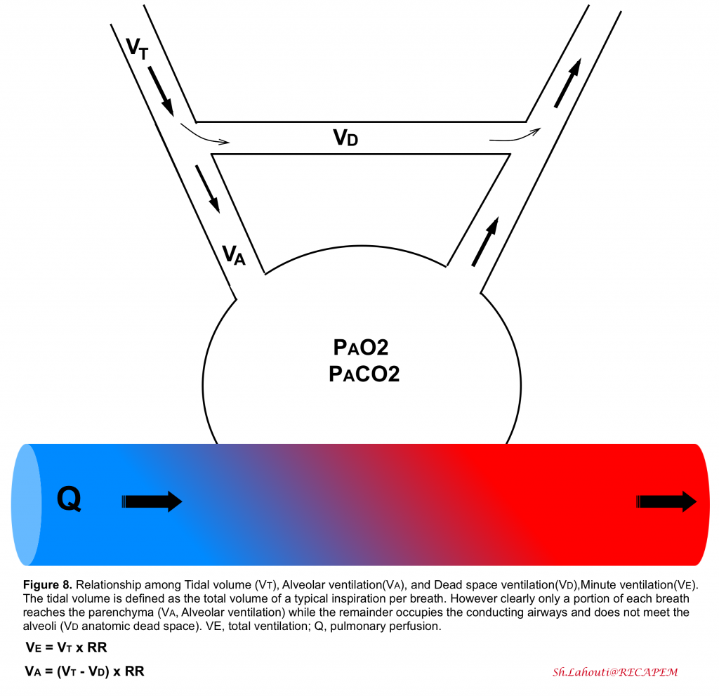 Adult Respiratory Distress: ABCs of Oxygenation and Ventilation | RECAPEM