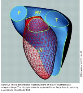 Acute Right Heart Failure: Principles of Diagnosis and Management In ...
