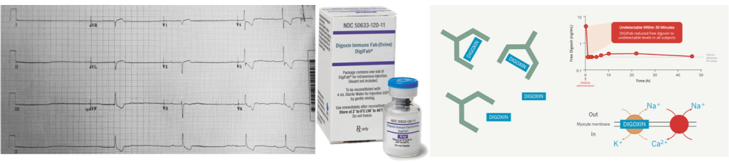 Digoxin Toxicity | RECAPEM