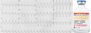 Sodium Channel Blocker Toxicity | RECAPEM